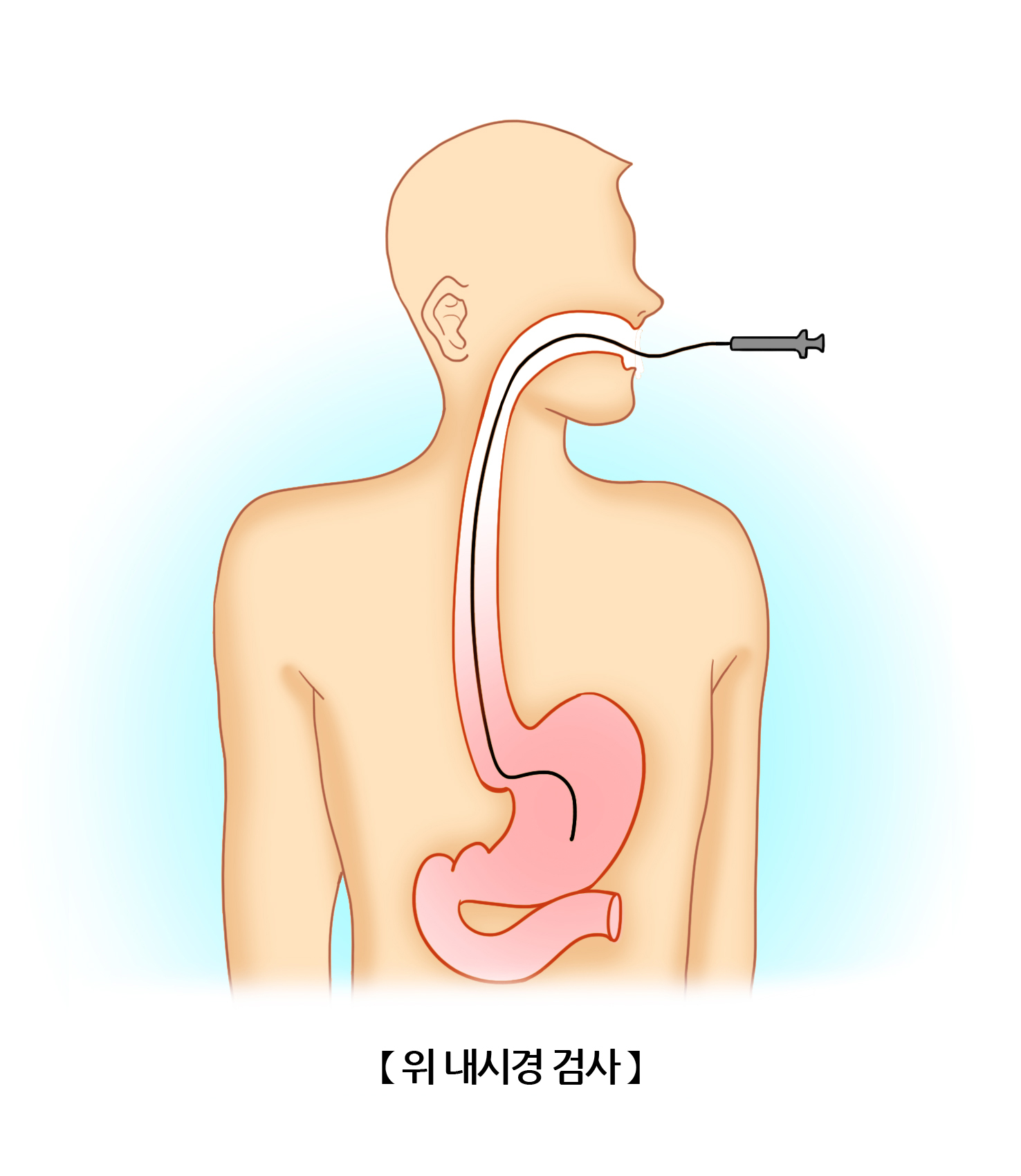 위 내시경검사 검사시술수술 정보 의료정보 건강정보 서울아산병원
